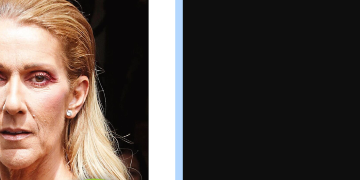 Céline Dion : Un traitement médical à domicile pour une maladie rare ...