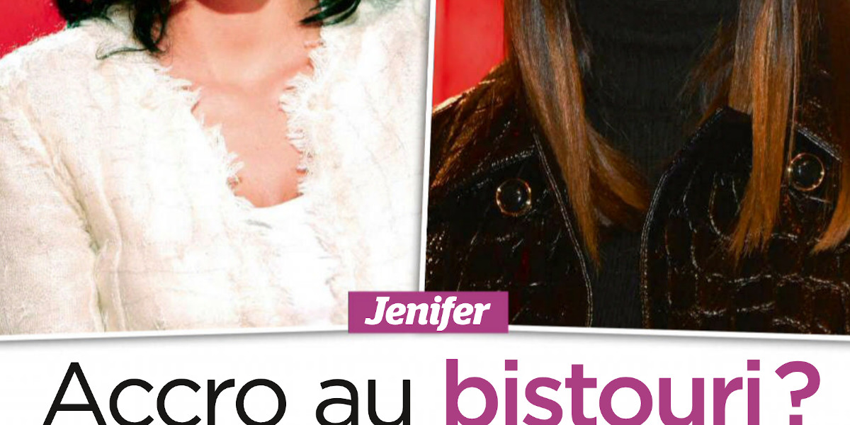 Jenifer accro au bistouri, la surprenante leçon de Marion Cotillard