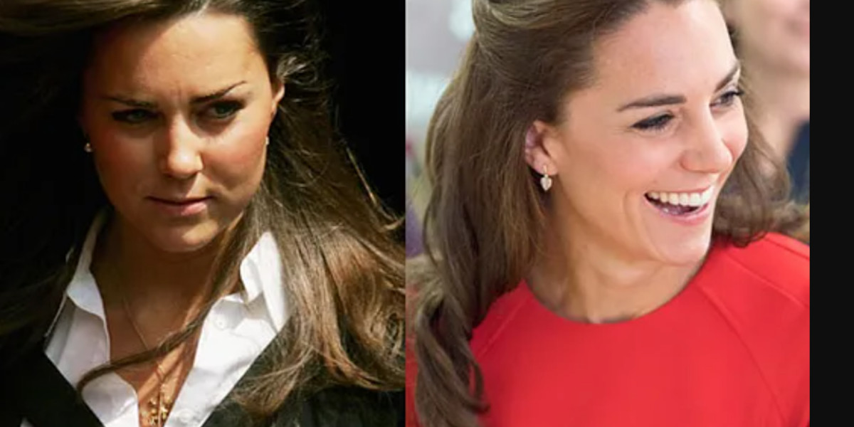 Kate Middleton adepte de chirurgie esthétique, ces « retouches ...