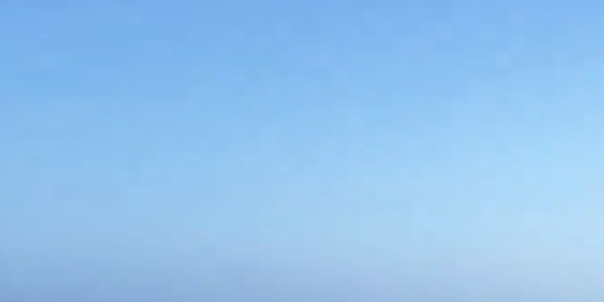 Forent Pagny - Cette particularité physique qui rend unique sa fille ...